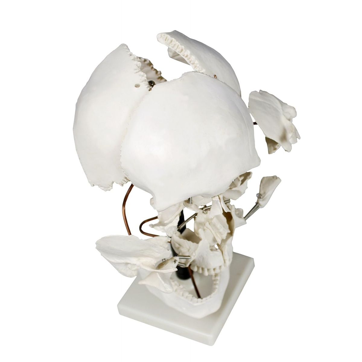 Exploded Human Skull Model - MYASKRO